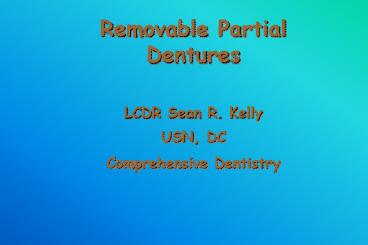 Removable Partial Dentures presentation | free to view
