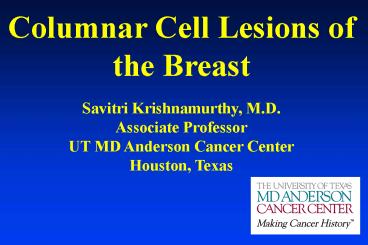 PPT – Columnar Cell Lesions of the Breast PowerPoint presentation ...