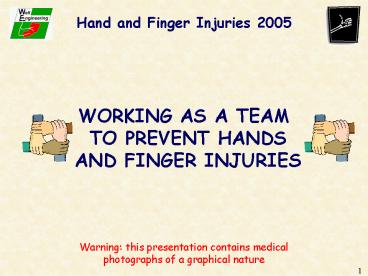 Hand and Finger Injuries 2005 presentation | free to view