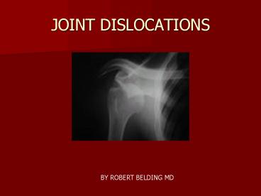 JOINT DISLOCATIONS presentation | free to view