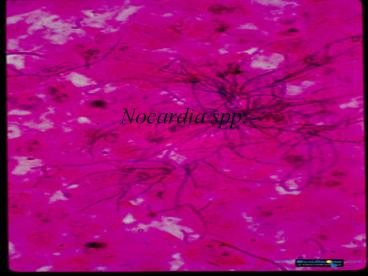 Nocardia spp' presentation | free to view