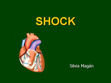 PPT – SHOCK PowerPoint presentation | free to view - id: 28d908-OTQxY