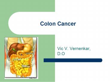 Colon Cancer presentation | free to view
