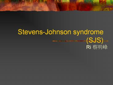 Stevens-Johnson syndrome (SJS) presentation | free to view