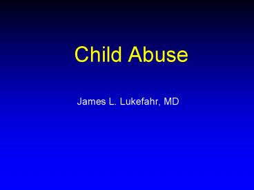 Child Abuse presentation | free to view