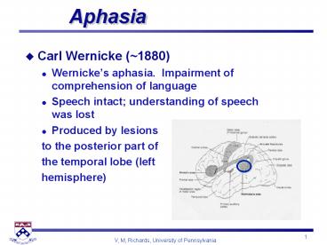 Aphasia presentation | free to view