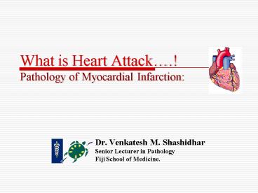 PPT – What is Heart Attack. Pathology of Myocardial Infarction ...