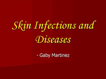 PPT – Skin Infections and Diseases PowerPoint presentation | free to ...