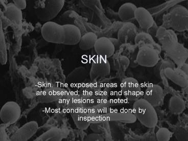 PPT – SKIN PowerPoint presentation | free to view - id: 28109-YTU0O