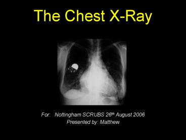 The Chest XRay presentation | free to view