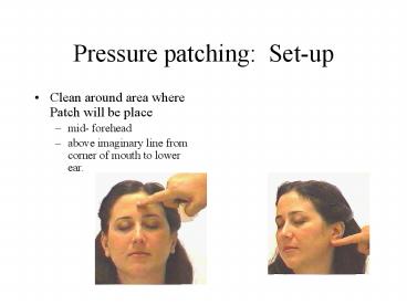 PPT – Pressure patching: Setup PowerPoint presentation | free to view ...