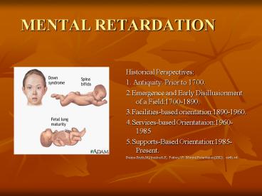 MENTAL RETARDATION presentation | free to view