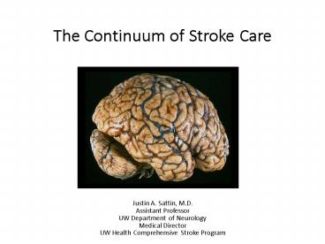 The Continuum of Stroke Care presentation | free to view