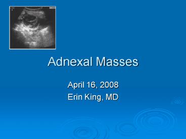 Adnexal Masses presentation | free to view