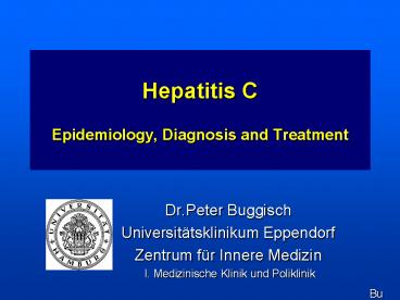 Hepatitis C Epidemiology, Diagnosis and Treatment presentation | free ...