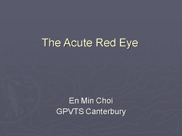 The Acute Red Eye presentation | free to view