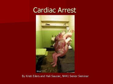 Cardiac Arrest presentation | free to view