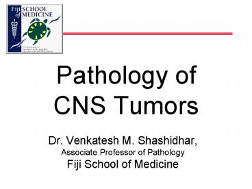 PPT – Pathology of CNS Tumors PowerPoint presentation | free to view - id: 4d6fb-Nzk1M