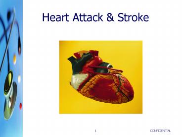 Heart Attack presentation | free to view