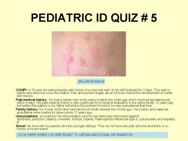PPT – PEDIATRIC ID QUIZ PowerPoint presentation | free to view - id ...
