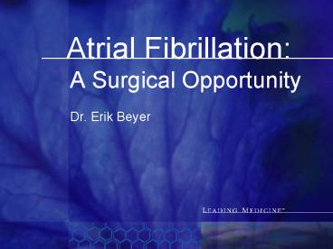 PPT – Atrial Fibrillation: PowerPoint presentation | free to view - id ...