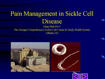 PPT – What is Sickle Cell Disease PowerPoint presentation | free to ...