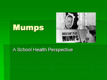 Mumps presentation | free to view
