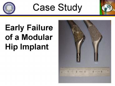 Early Failure of a Modular Hip Implant presentation | free to view