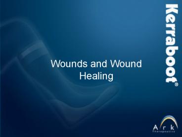 PPT – Wounds and Wound Healing PowerPoint presentation | free to view ...