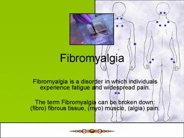 PPT – Fibromyalgia PowerPoint presentation | free to view - id: 8102d-ZDc1Z