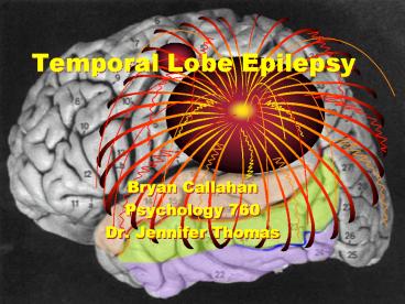 Temporal Lobe Epilepsy presentation | free to view