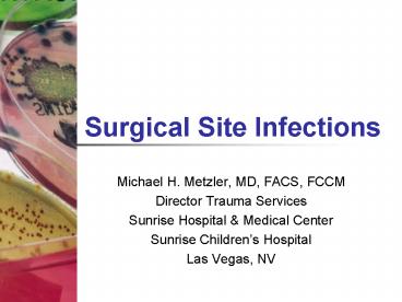 Surgical Site Infections presentation | free to view