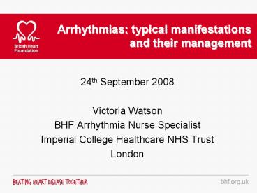 Arrhythmias: typical manifestations and their management presentation ...