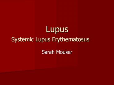 Lupus Systemic Lupus Erythematosus presentation | free to view