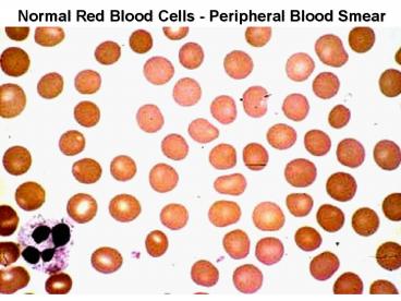 Normal Red Blood Cells Peripheral Blood Smear presentation | free to view
