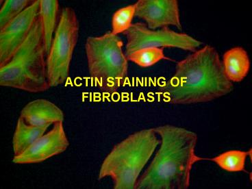 PPT – ACTIN STAINING OF FIBROBLASTS PowerPoint presentation | free to ...