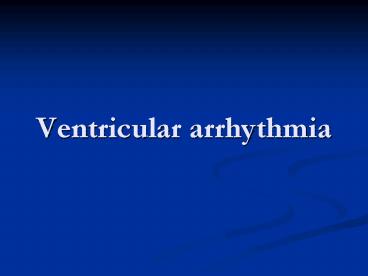 Ventricular arrhythmia presentation | free to view