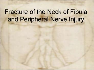 Fracture of the Neck of Fibula and Peripheral Nerve Injury presentation ...