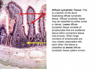PPT – Diffuse Lymphatic Tissue' This is a section of the ileum ...