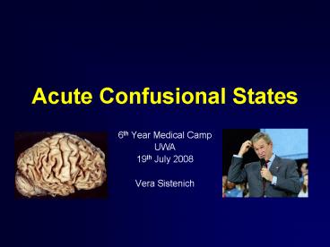 Acute Confusional States presentation | free to view
