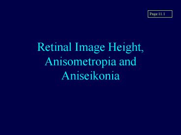 Retinal Image Height, Anisometropia and Aniseikonia presentation | free ...