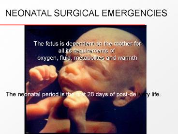 NEONATAL SURGICAL EMERGENCIES presentation | free to view