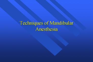 Techniques of Mandibular Anesthesia presentation | free to view