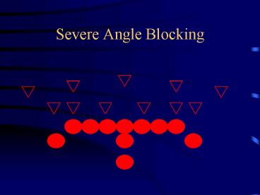 Severe Angle Blocking presentation | free to view
