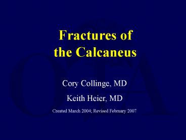 PPT – Fractures of the Calcaneus PowerPoint presentation | free to view ...