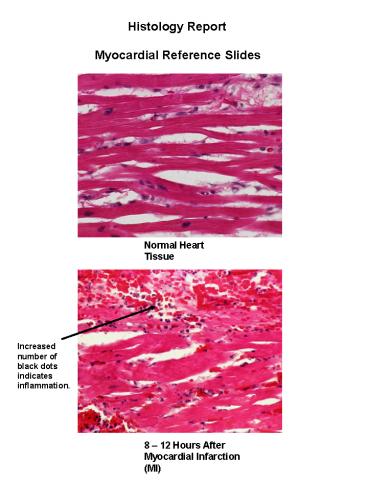 Histology Report presentation | free to view