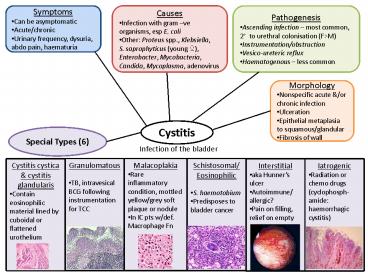 Cystitis presentation | free to view