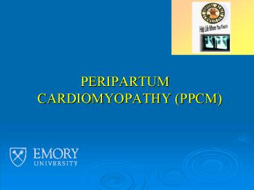 PERIPARTUM CARDIOMYOPATHY PPCM presentation | free to view