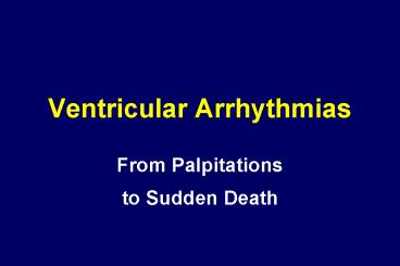 Ventricular Arrhythmias presentation | free to view