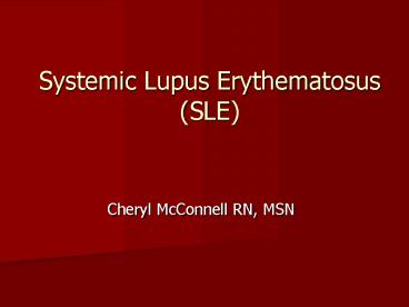 Systemic Lupus Erythematosus SLE presentation | free to view